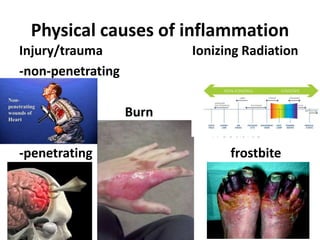 4. lecture four Molecular Mechanism of Inflammation.pptx