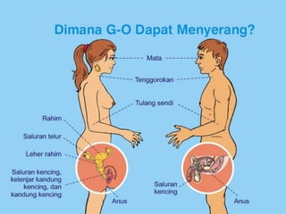Gonorrhea Penyakit Menular Seksual...pptx