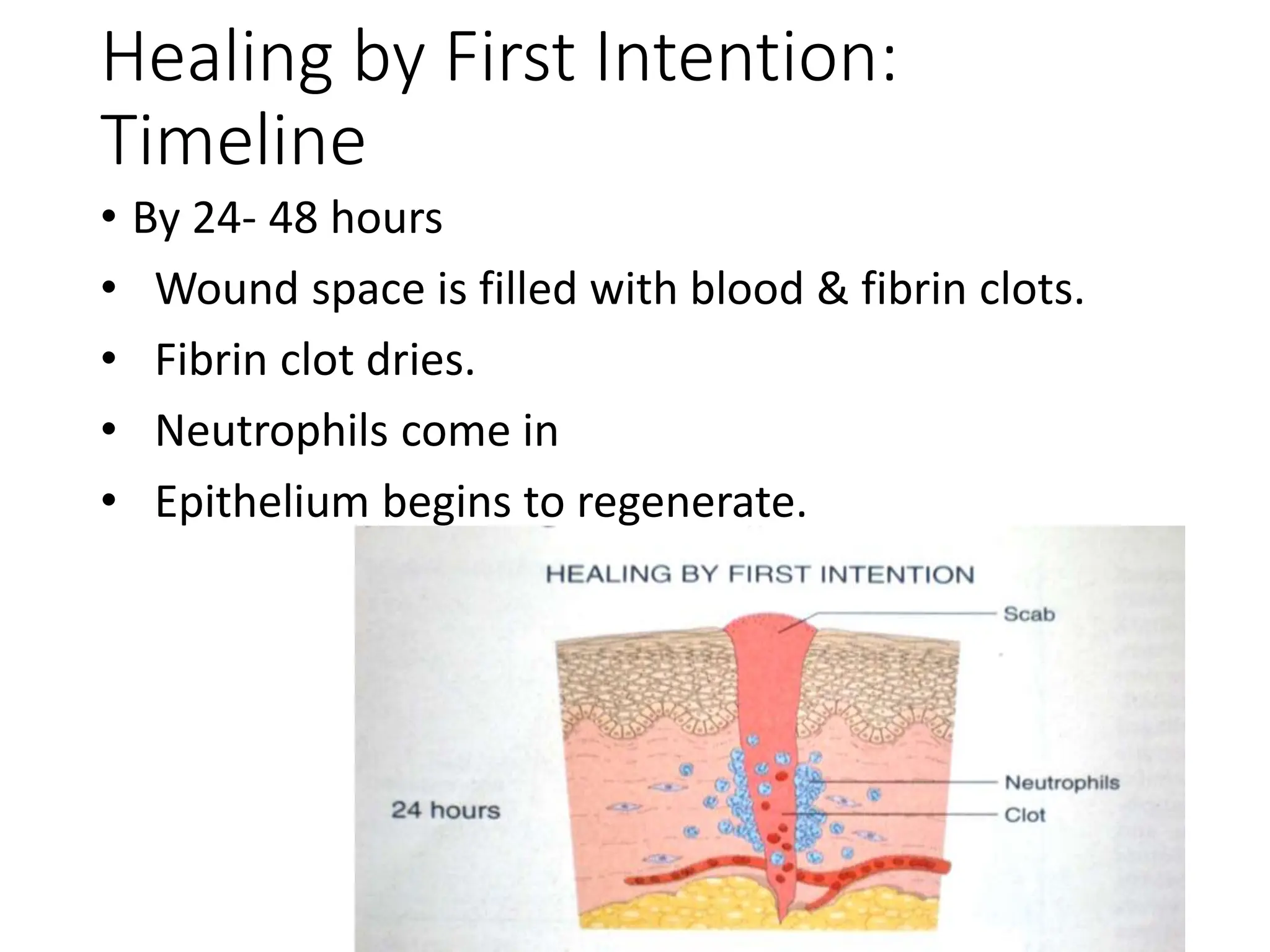 4. Pathology -midwifery stu-Tissue repair(1).ppt