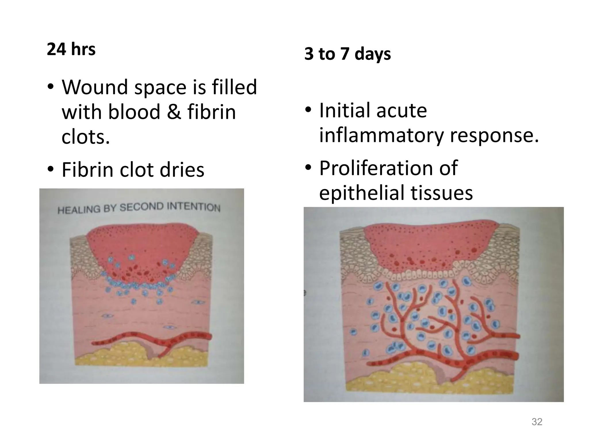 4. Pathology -midwifery stu-Tissue repair(1).ppt