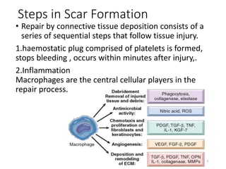 4. Pathology -midwifery stu-Tissue repair(1).ppt