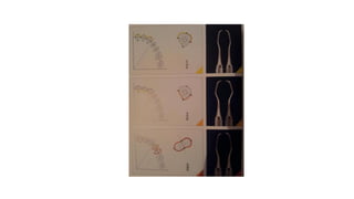 4.Chiuretaj pe câmp închis.,,,,,,,,,,pdf | PPT