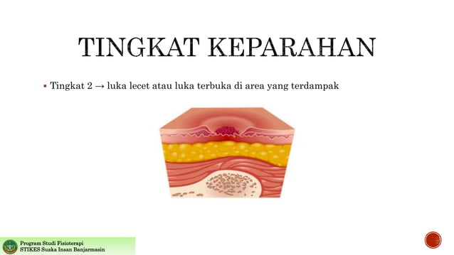 MATERI FISIOLOGI SISTEM INTEGUMEN SARJANA FISIOTERAPI.pptx