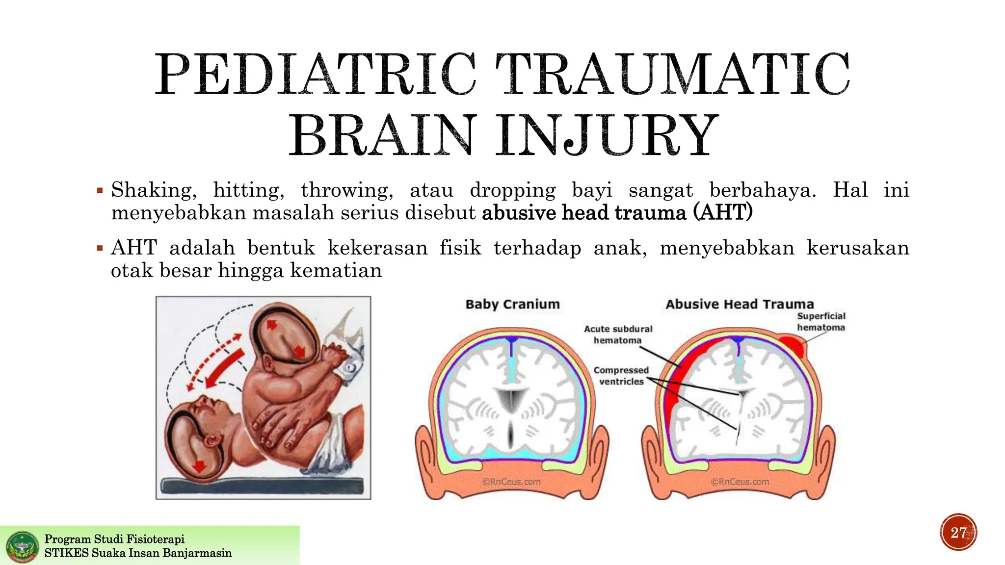 FISIOTERAPI PEDIATRI - TRAUMATIC BRAIN INJURY.pptx
