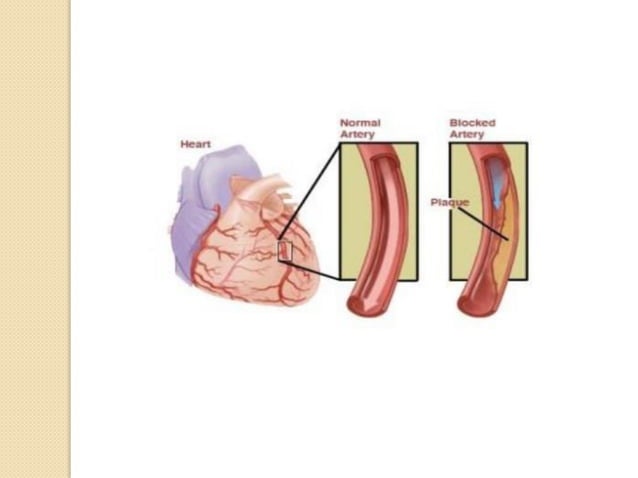 4. Anti Anginal.pdf What's anginal pectoris | PPT | Free Download