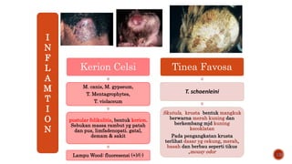 4. dermatomikosis definition,etiology,clinical manifestation (wulan).pptx