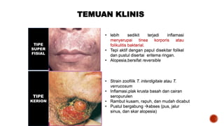 4. dermatomikosis definition,etiology,clinical manifestation (wulan).pptx