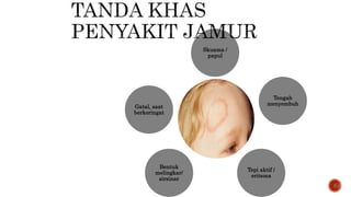 4. dermatomikosis definition,etiology,clinical manifestation (wulan).pptx