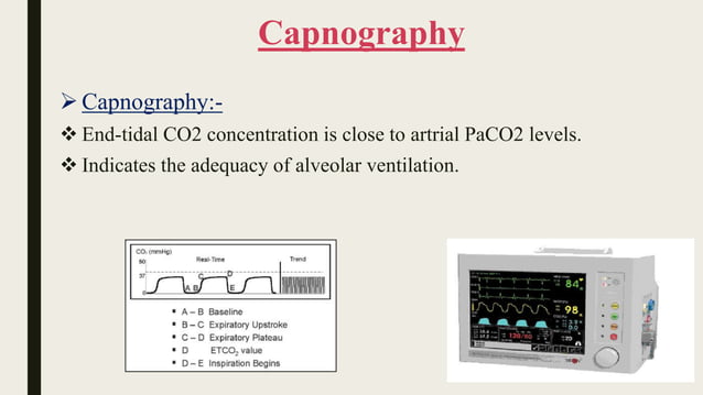 4.Intensive care monitoring system .pptx