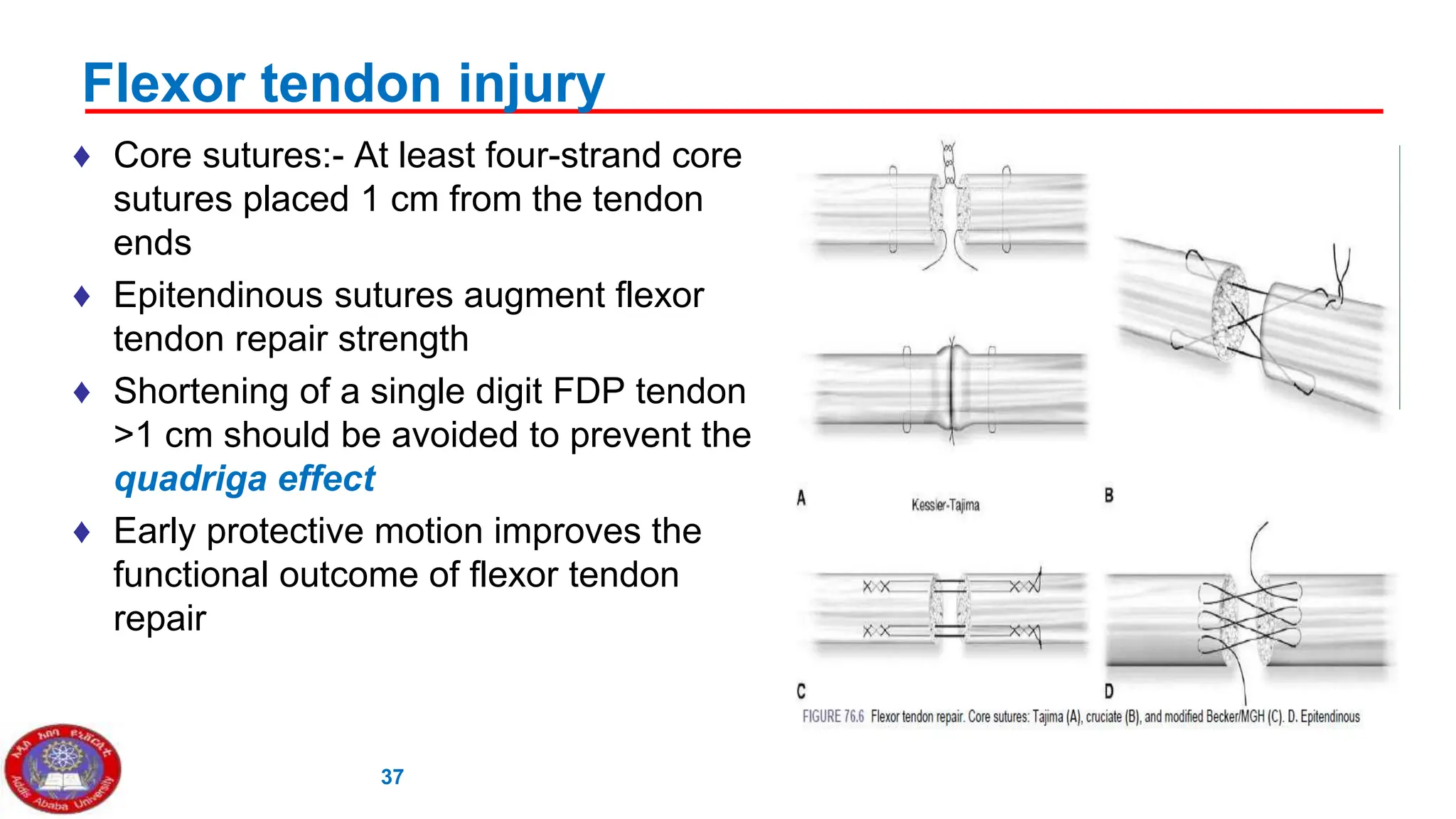 4. Hand Injury Management 2gggggg021.pptx