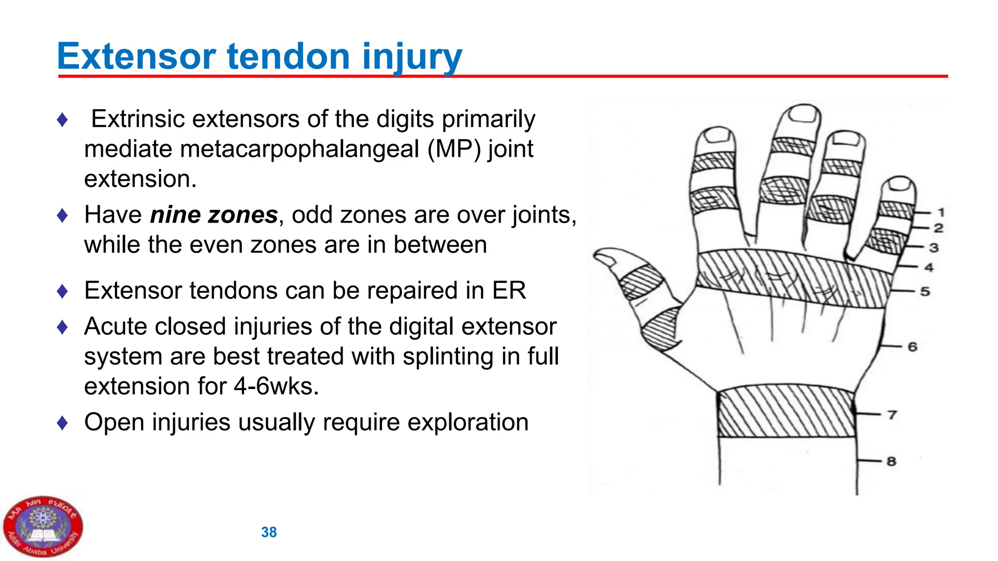 4. Hand Injury Management 2gggggg021.pptx