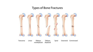 Understanding Bone Development and Disorders | PPTX