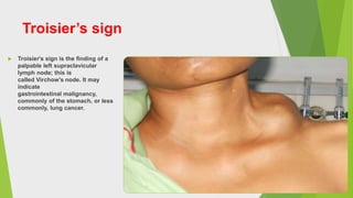 4. Gastric Cancer.pptx7777777777777777777777 | PPTX | Digestive ...