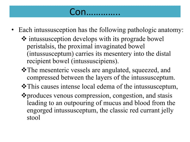 4.Management of IHPS and Intussusception.pptx
