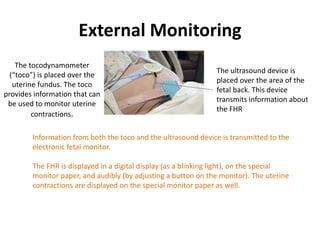 4. FETAL SURVEILENCE AND INTRAPARTUM FETAL MONITORING - Copy.pptx
