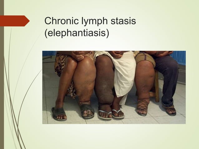 4 Microcirculatiomicrocirculation Presentation Ppt