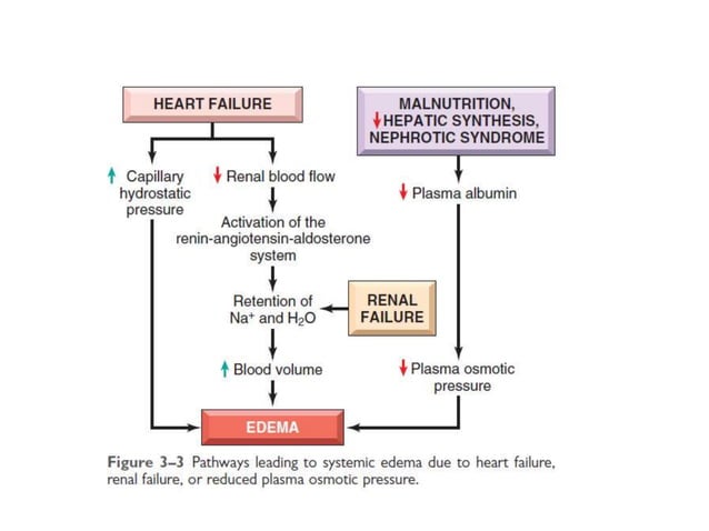 4. Hemodynamic disorders (Edema, Hemorrhage, thrombosis, embolism)(1).ppt