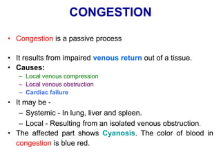 4. Hemodynamic disorders (Edema, Hemorrhage, thrombosis, embolism)(1).ppt