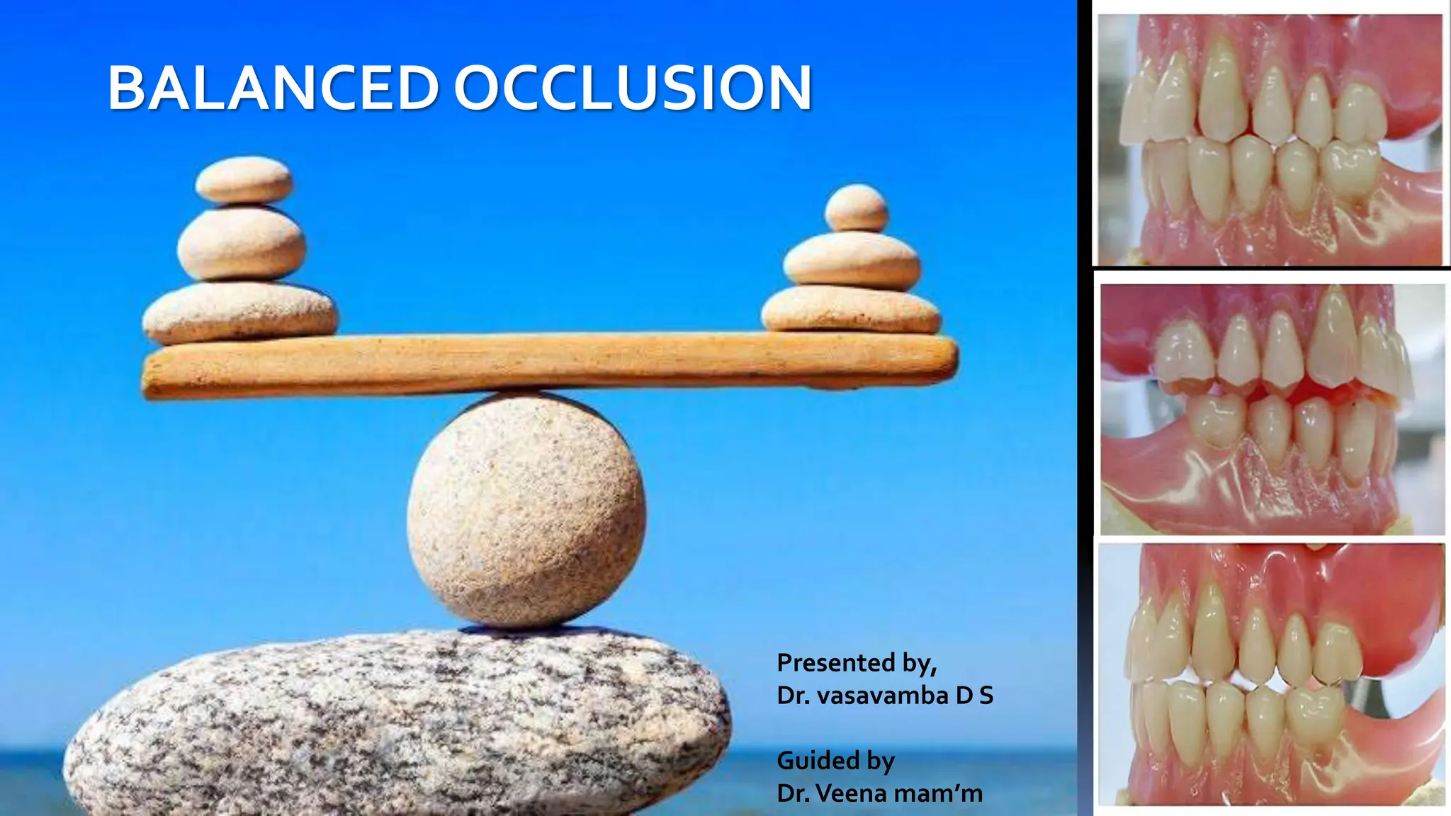 4. BALANCED OCCLUSION balanced occlusion | PPT
