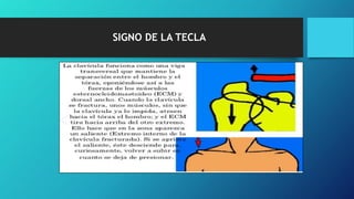 4.CUIDADOS DE ENFERMERÍA EN PACIENTES CON FRACTURA DE CLAVÍCULA.pdf