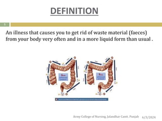 4. DIARROEAL DISEASE and its treatment .ppt