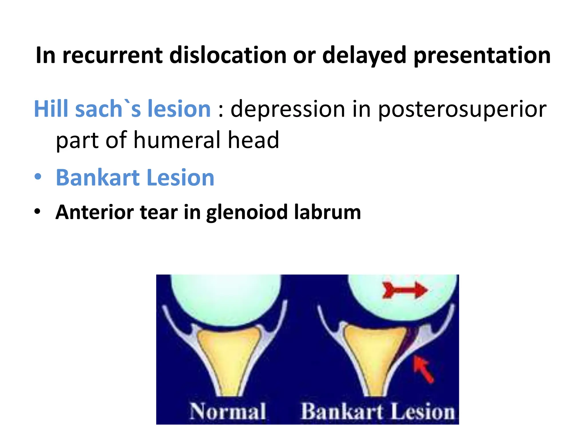 4. Acute Shoulder Dislocations cme ankit.pptx