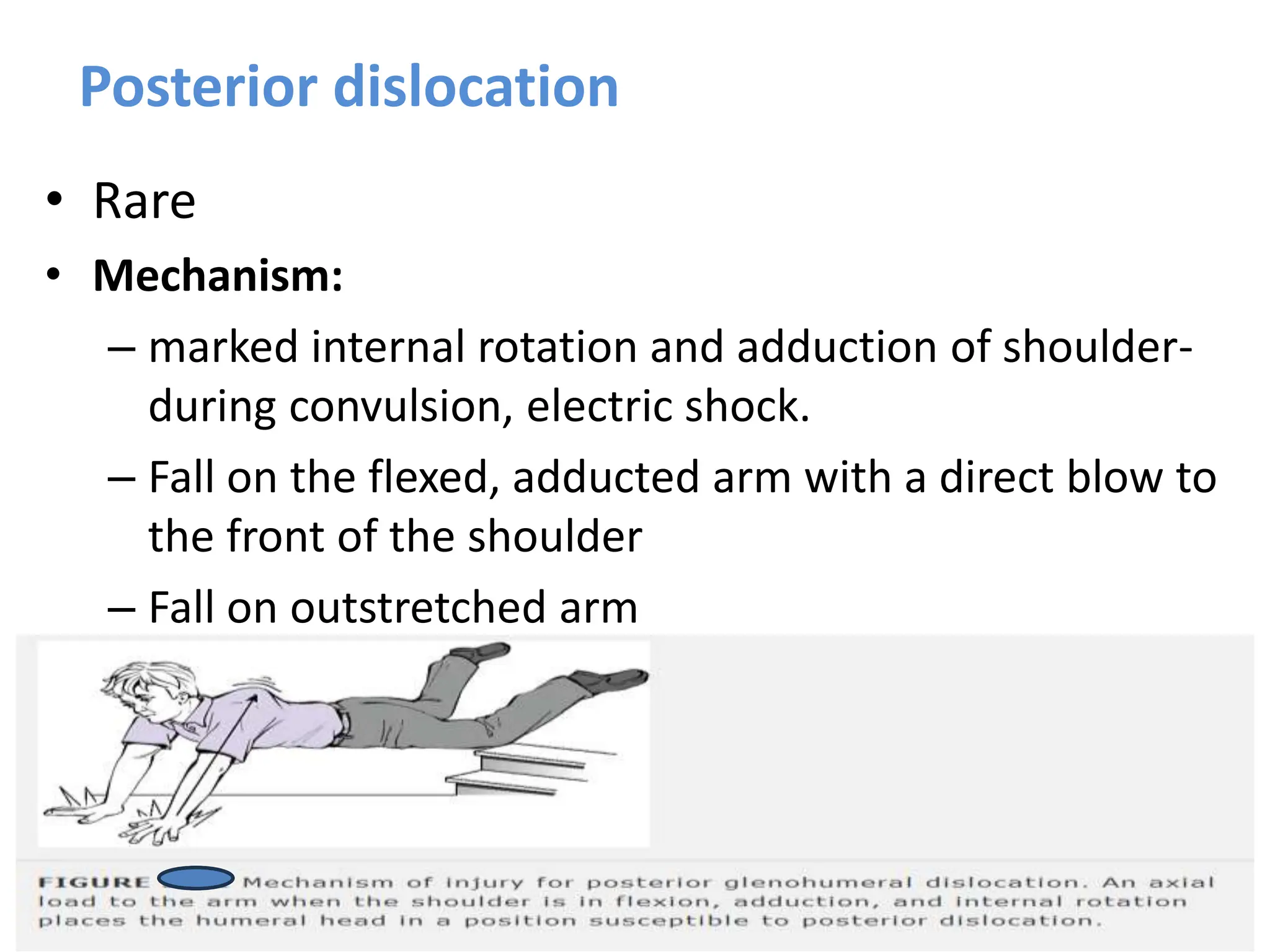 4. Acute Shoulder Dislocations cme ankit.pptx