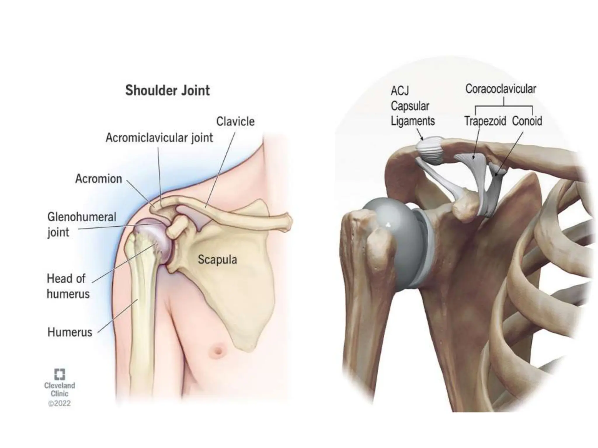 4. Acute Shoulder Dislocations cme ankit.pptx