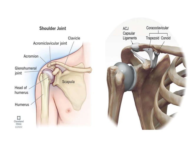 4. Acute Shoulder Dislocations cme ankit.pptx