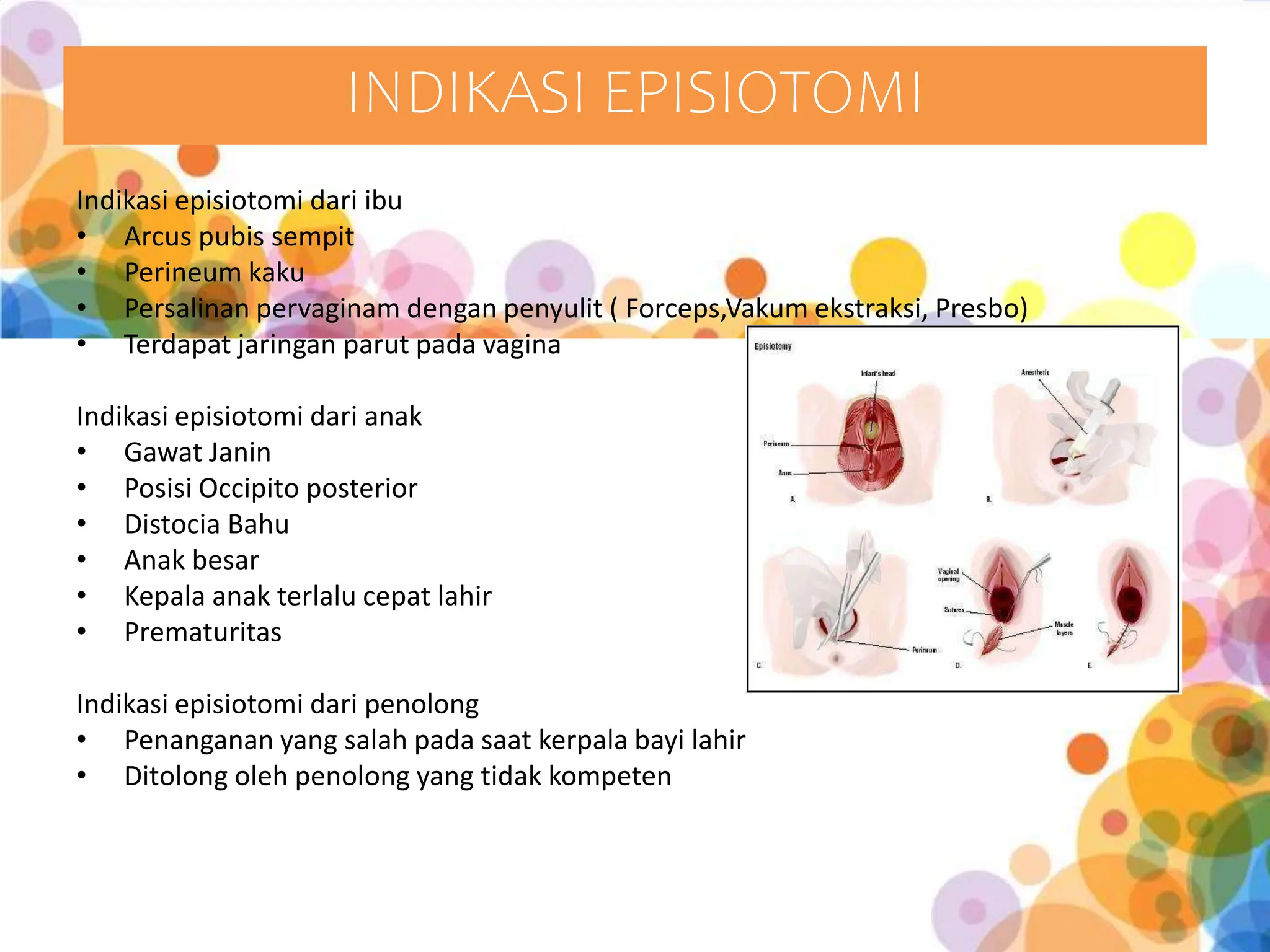 4. EPISIOTOMI.ppt pada pirenium ibu bersalin | PPT