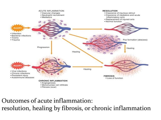 4._Morphologic_Patterns_&_Outcomes_of_Acute_Inflammation.pptx ...