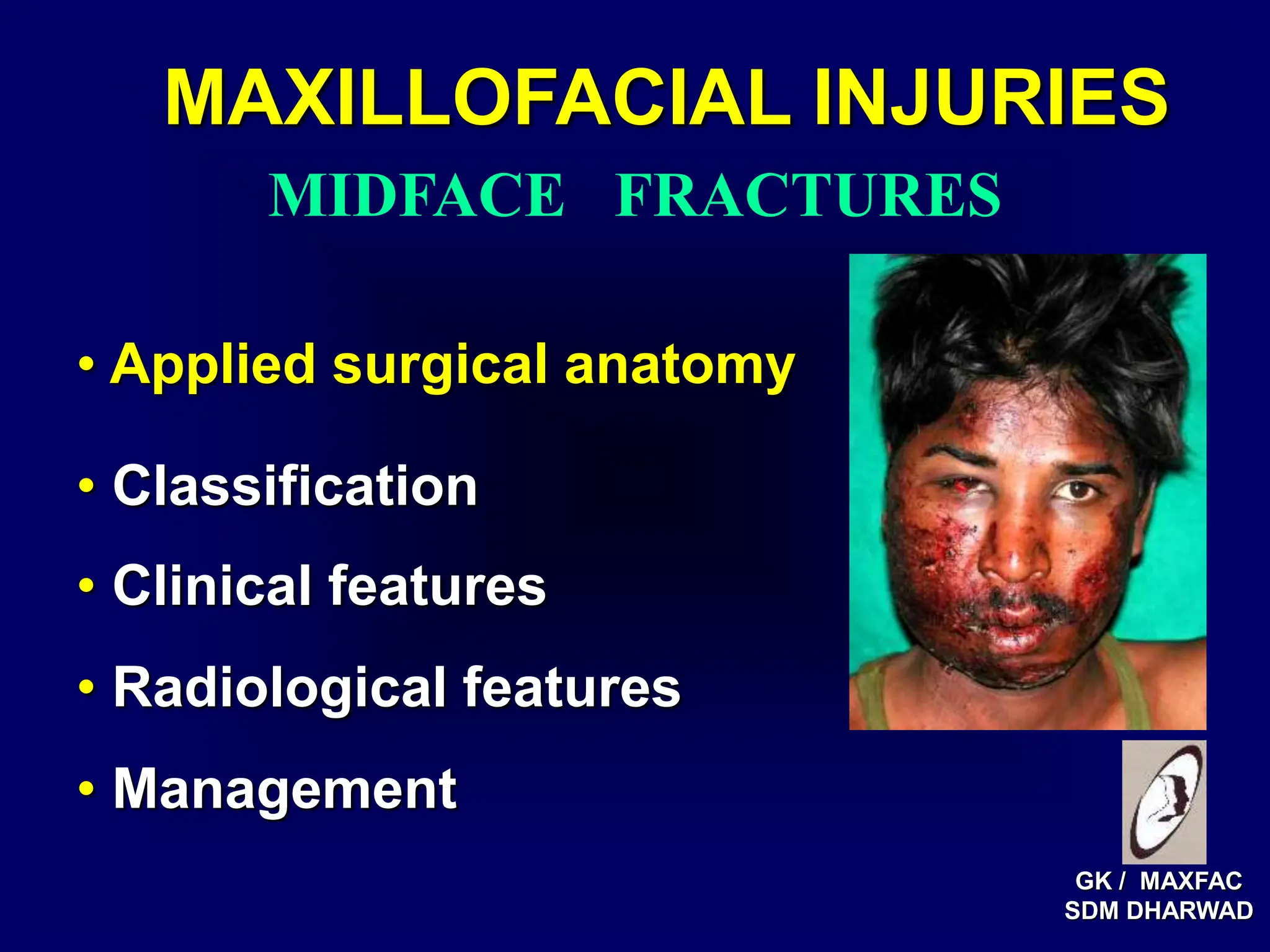 4. mid face fracture ppt for ug students | PPT