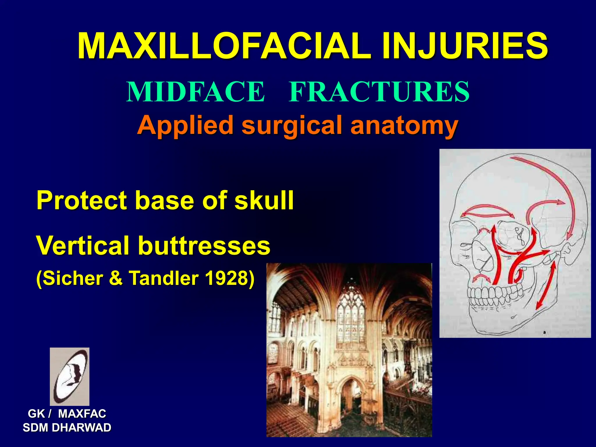 4. mid face fracture ppt for ug students | PPT
