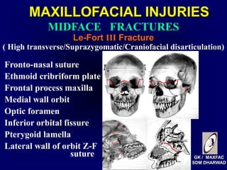 4. mid face fracture ppt for ug students | PPT | Death, Injury, or ...