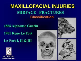 4. mid face fracture ppt for ug students | PPT | Death, Injury, or ...