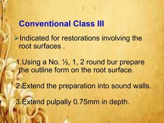 4. Composite cavity preparation (1).pptx