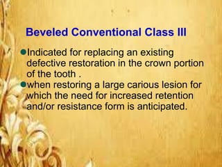 4. Composite cavity preparation (1).pptx