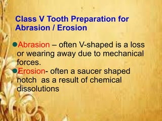 4. Composite cavity preparation (1).pptx