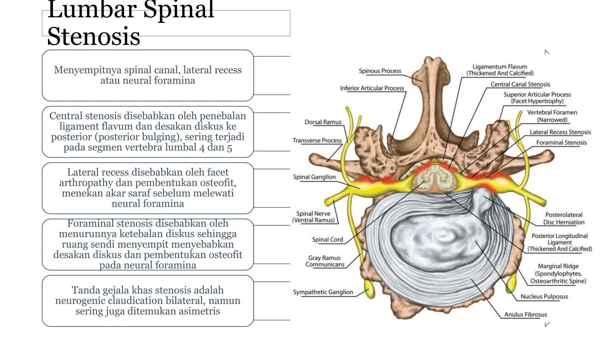 4. Degenerasi Diskus Intervertebral.pptx