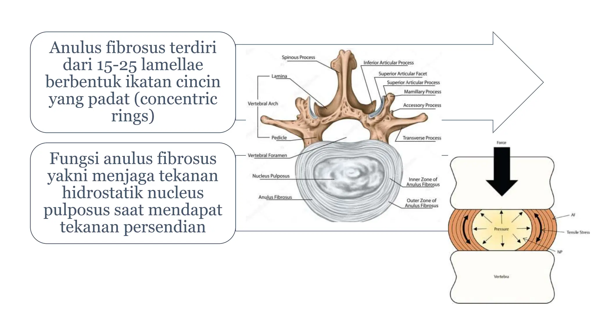 4. Degenerasi Diskus Intervertebral.pptx