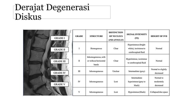 4. Degenerasi Diskus Intervertebral.pptx