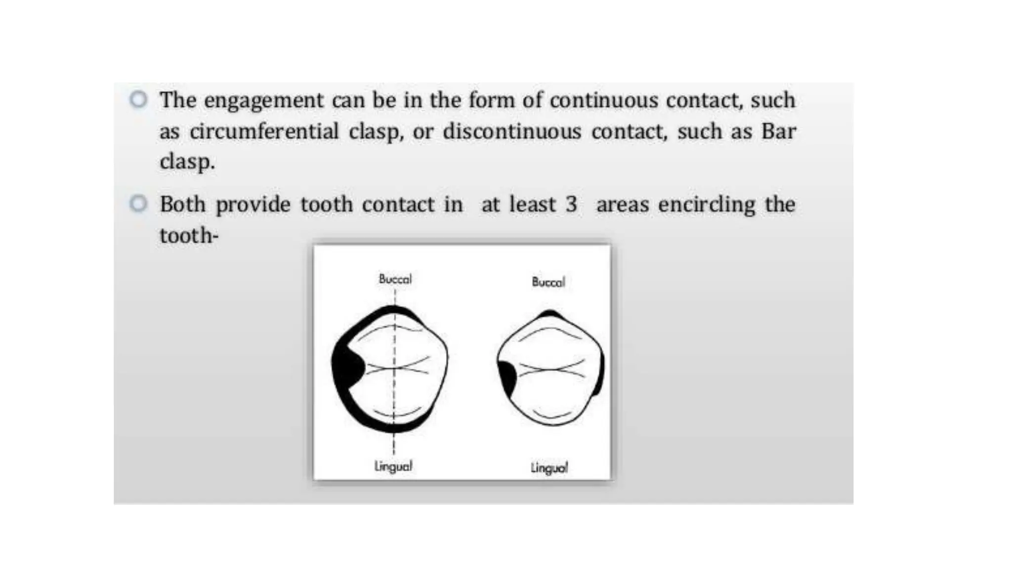 4. Direct Retainers and Indirect Retainers.pptx