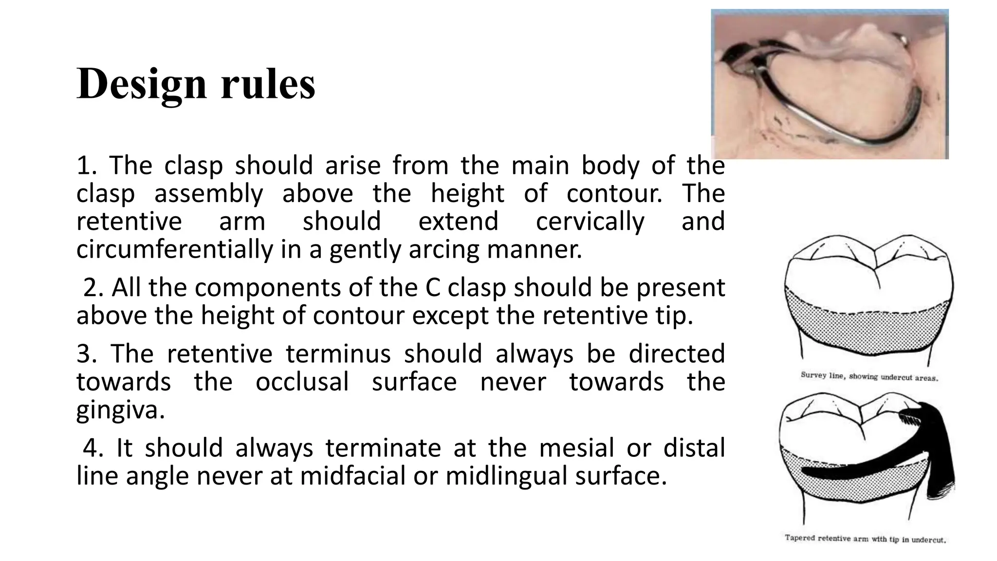4. Direct Retainers and Indirect Retainers.pptx