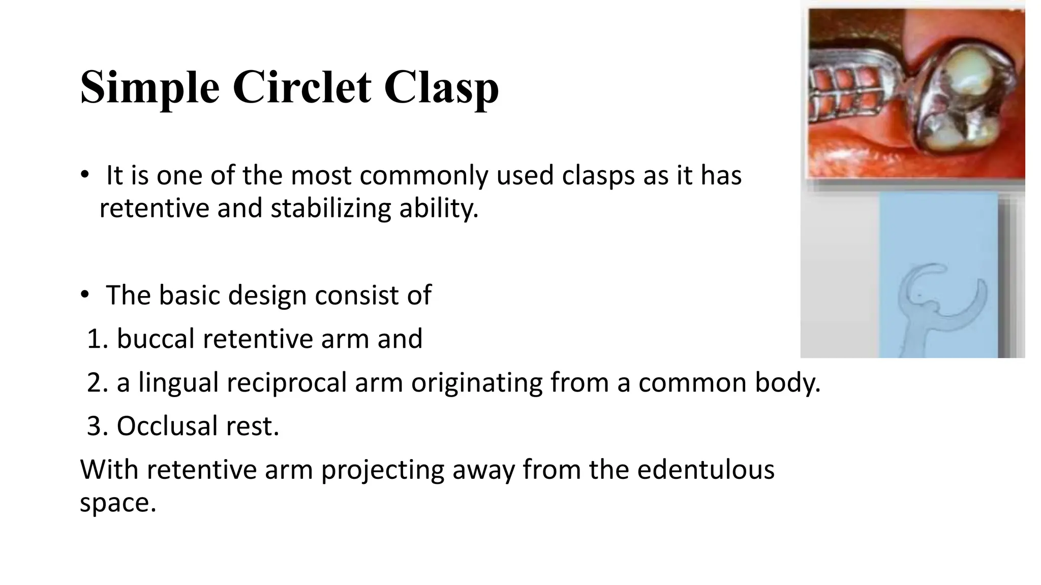 4. Direct Retainers and Indirect Retainers.pptx