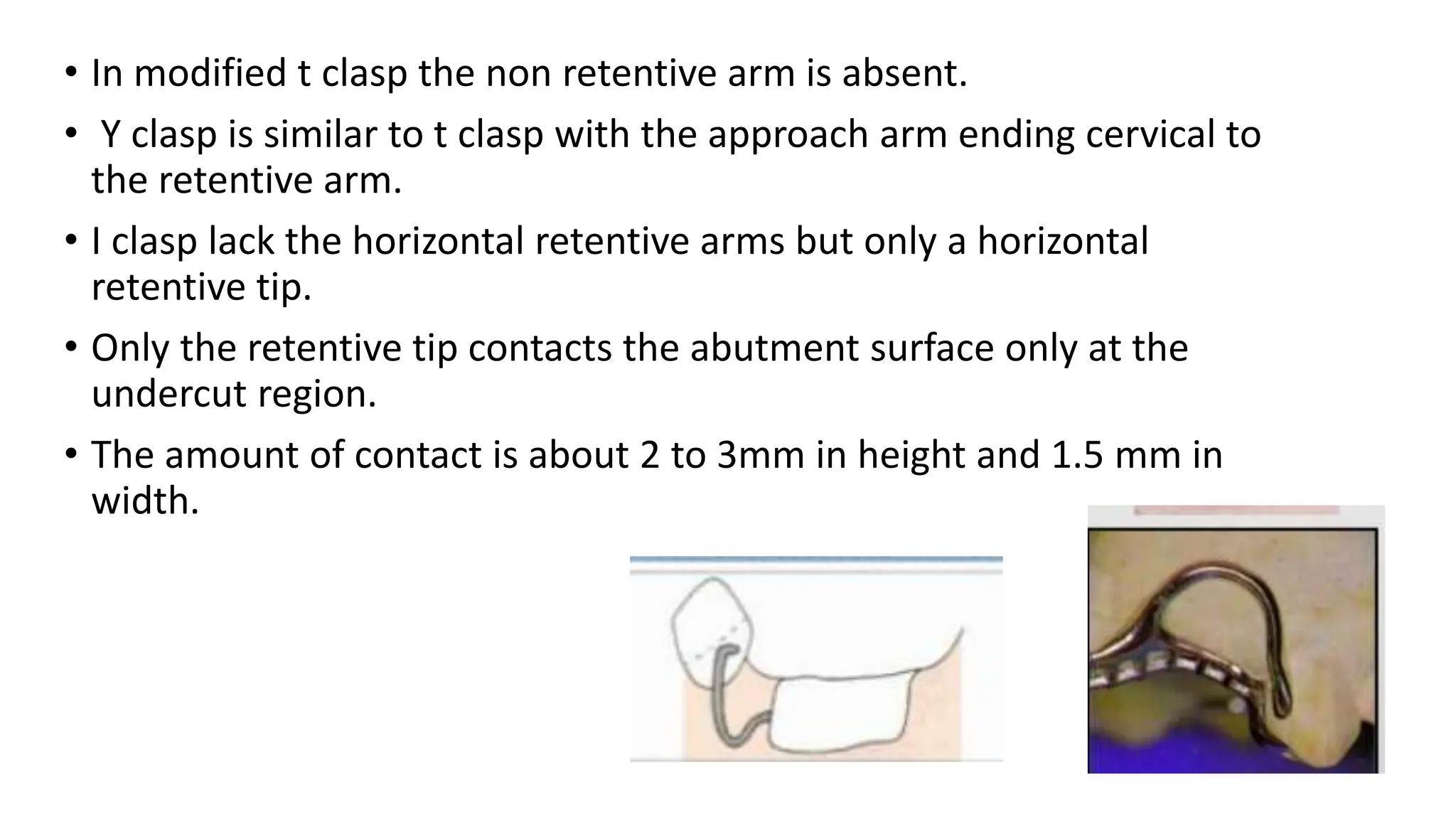 4. Direct Retainers and Indirect Retainers.pptx