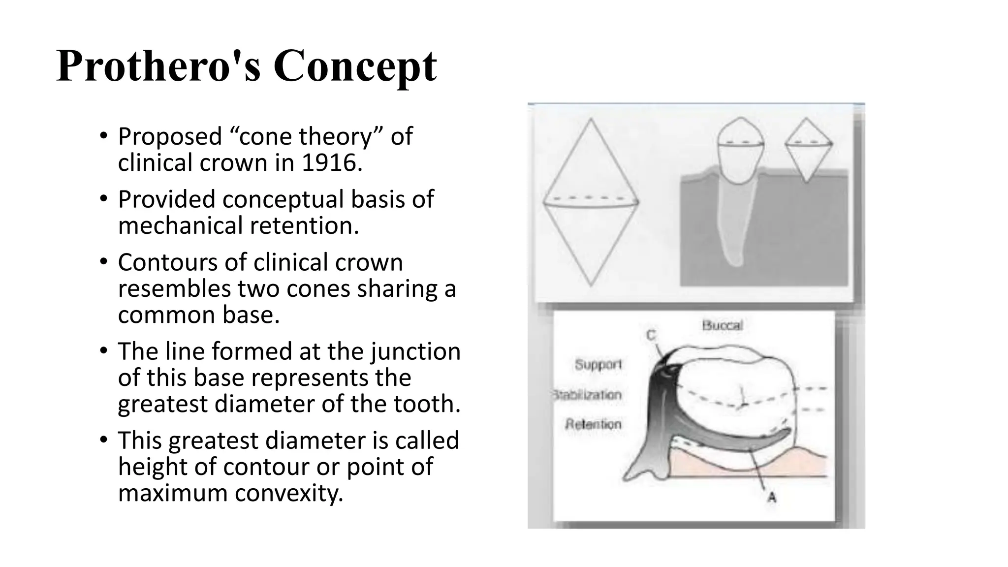 4. Direct Retainers and Indirect Retainers.pptx