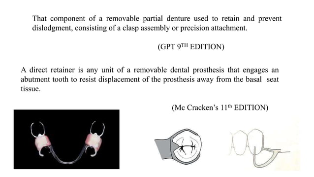 4. Direct Retainers and Indirect Retainers.pptx