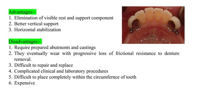 4. Direct Retainers and Indirect Retainers.pptx