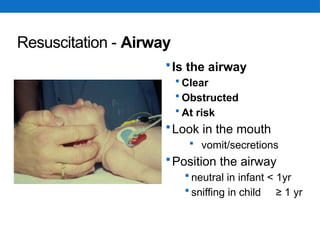 4. Basic Life Support in the Collapsed Infant and Child 2020.pptx