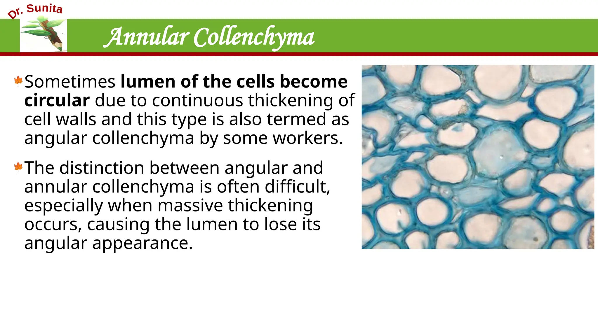 Simple permanent tissue- Parenchyma, Collenchyma and Sclerenchyma | PPTX